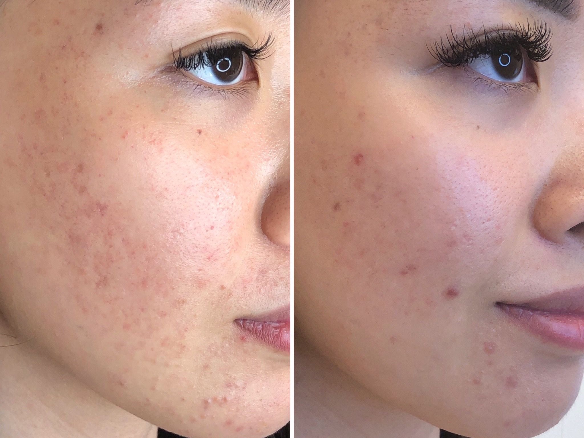 The Clinica: The Best Toronto Beauty Clinic
