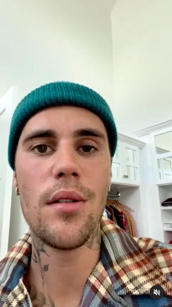 Justin Bieber Face Paralysis Update