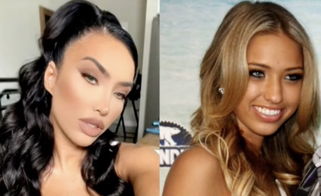 Bre Selling Sunset Plastic Surgery Transformation