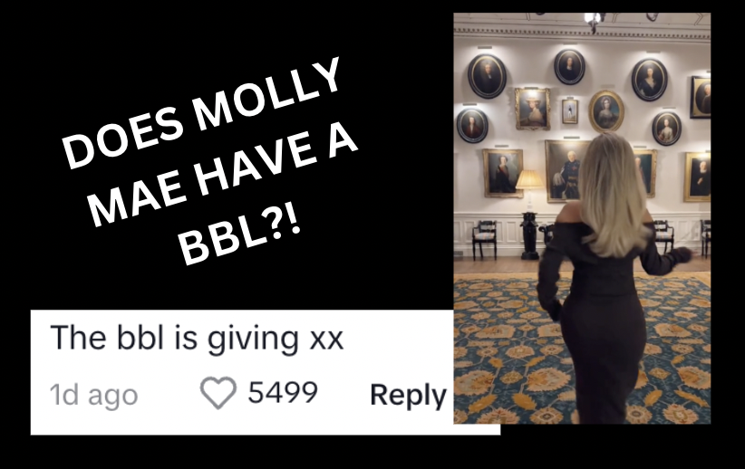 Does Molly Mae Have A BBL?