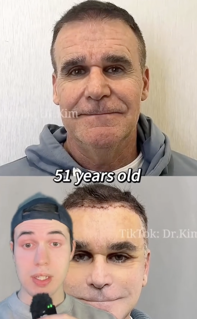 Who Is Dr Kim Plastic Surgeon TikTok Alleged Scary Facelift Surgeries?