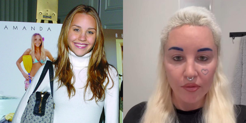 Amanda Bynes Before and After