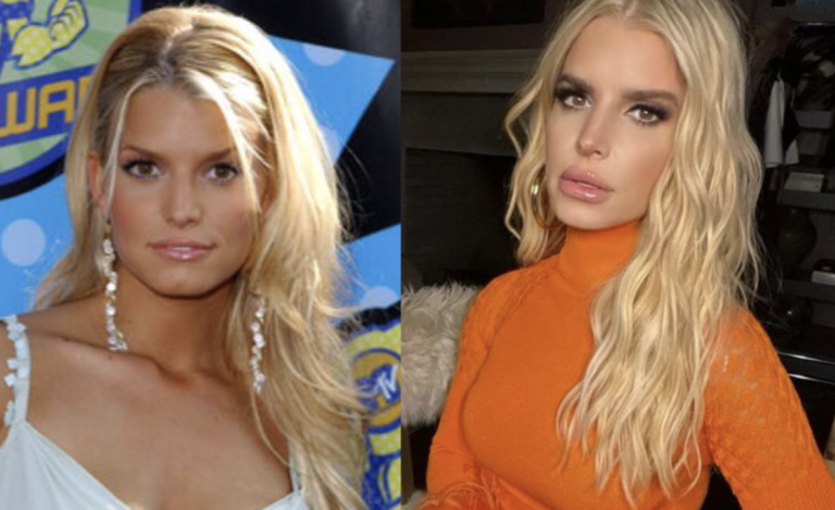 Will Alleged Plastic Surgery Keep Jessica Simpson Young?