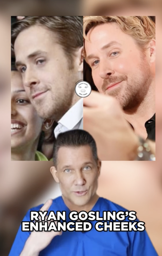 What Is Pillow Face Ryan Gosling Cheeks Plastic Surgery Face Rumors