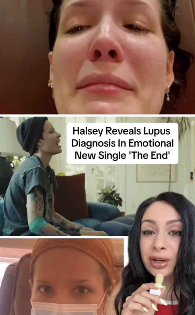 What Happened To Halsey Illness Lupus