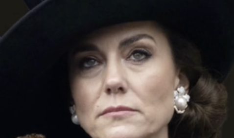 Did Kate Middleton Get A Facelift Before and After