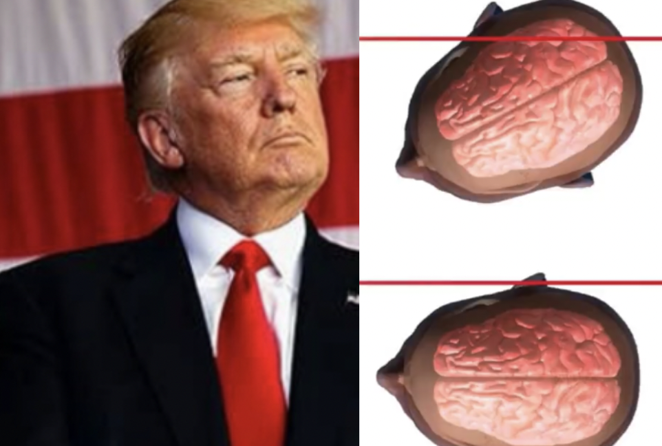 Where Was Bullet Supposed To Hit Trump If He Didn't Move His Head?