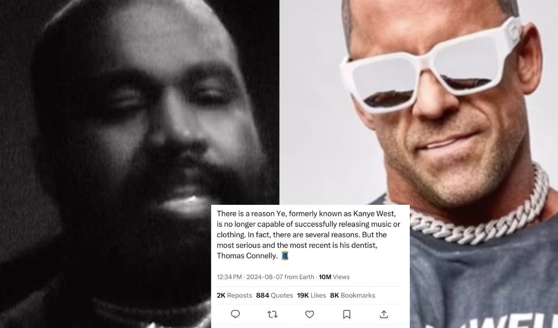 Kanye West Dentist Allegations Explained