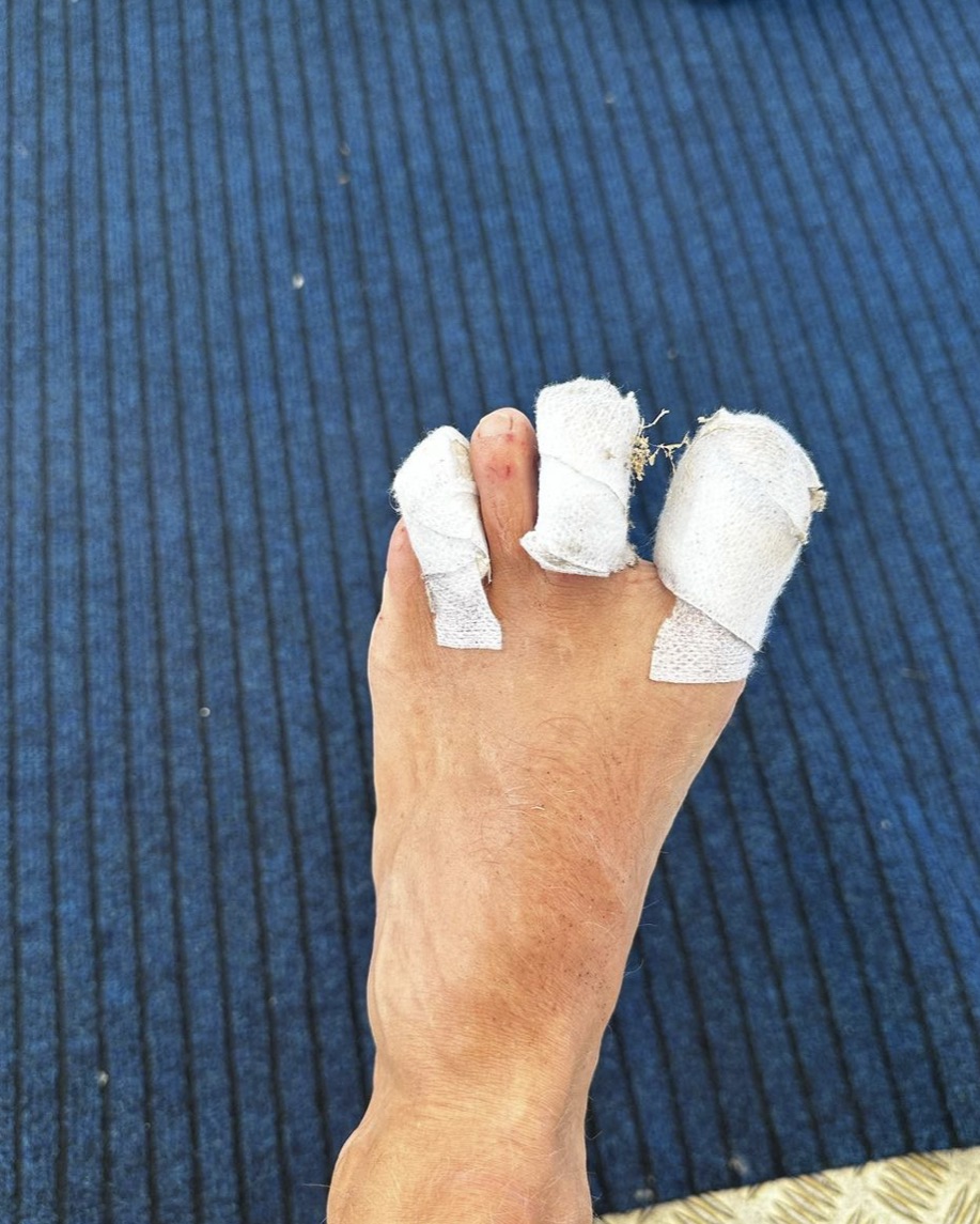 Colin Jost Addresses Foot Injury and Olympic Exit Rumours