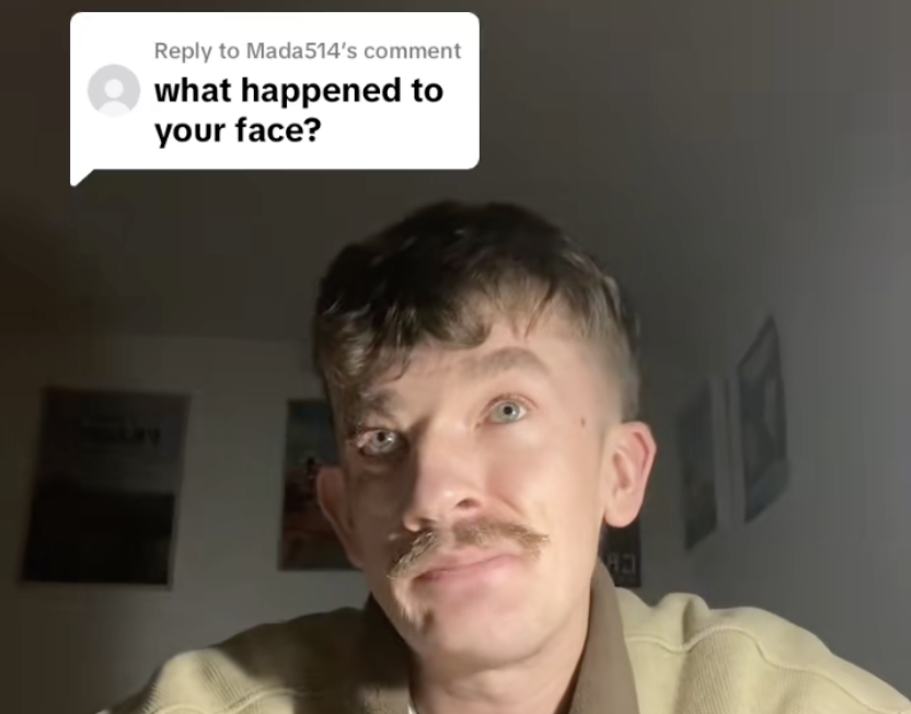 What Happened To Johnny's Face On The Apprentice?