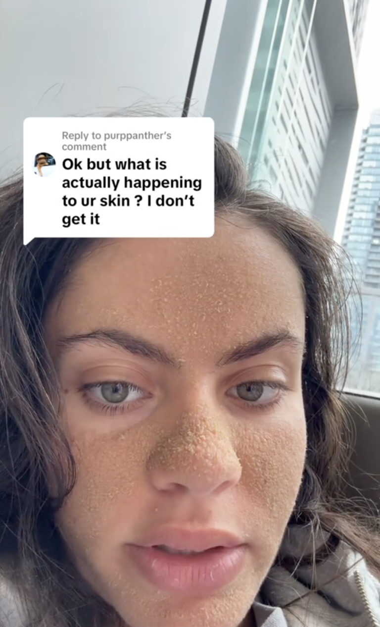 What Is Caveman Method Skin Tia Zakher TikTok Going Viral
