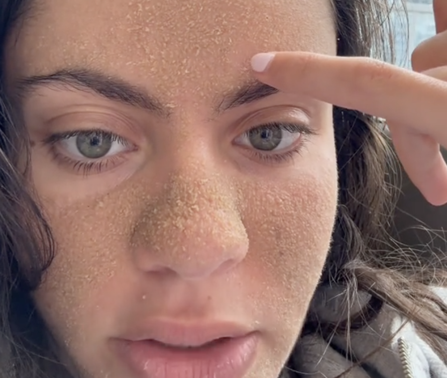 What Is Caveman Method Skin Tia Zakher TikTok Going Viral