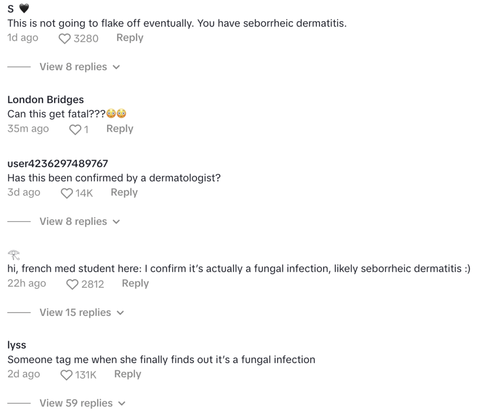 What Is Caveman Method Skin Tia Zakher TikTok Going Viral