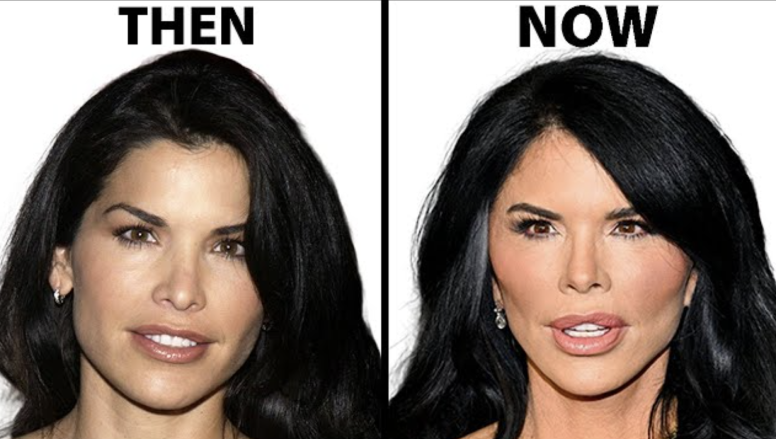 Lauren Sanchez Plastic Surgery Then and Now Revealed