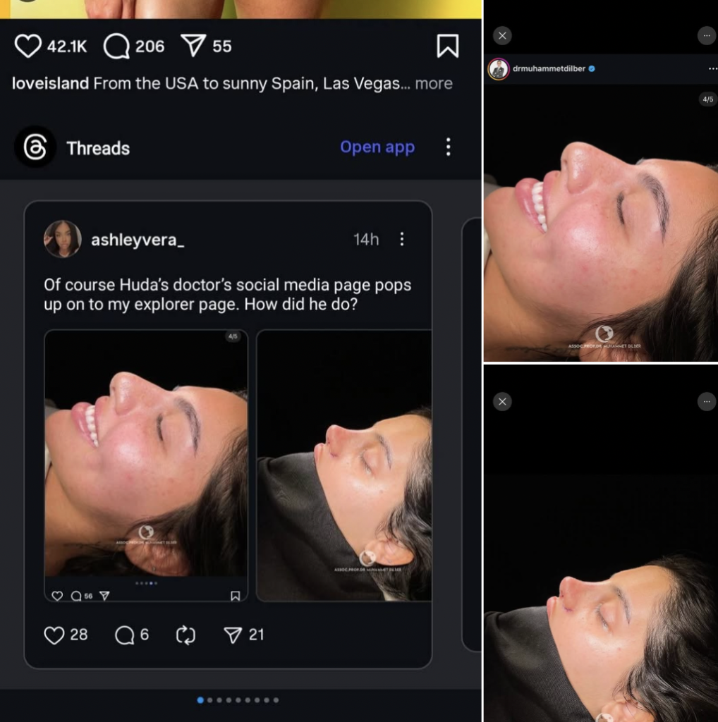 Huda Love Island Before Nose Job Photo Exposed